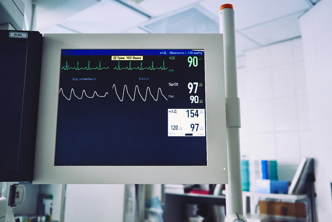 Holter Monitors vs. ECG Machines: Understanding Key Differences